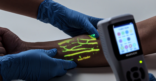 Vein Finder vs. Ultrasound: Which Is Better for Vein Visualization ...